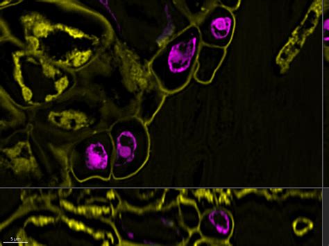 Imaris Clearview Gpu Accelerated Deconvolution For Microscopy
