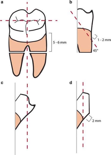 Tooth Specimen Preparation For Microhardness Testing A After The Root Download Scientific