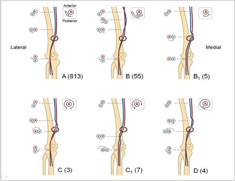 Schematic Drawings Of Different Types Of Three Dimensional Positional
