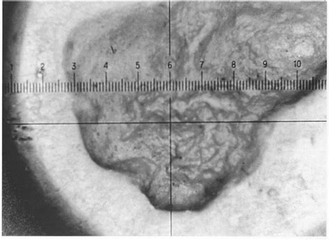 Positive Cast Of Type V Open Diagonal Twining Z Twisted Weft No
