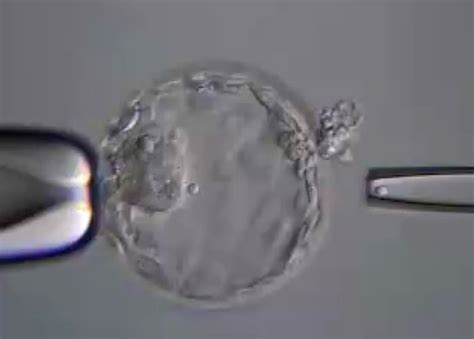 Preimplantation Genetic Testing PGT Boca Raton Aventura FL