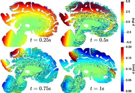New Mox Report On Polytopal Discontinuous Galerkin Discretization Of Brain Multiphysics Flow