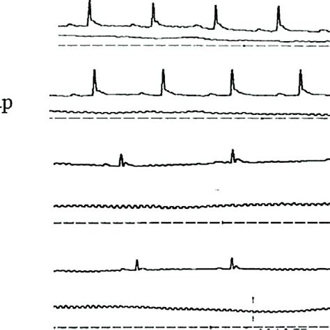 The Data For Electrocardiogram Evaluation Download Scientific Diagram