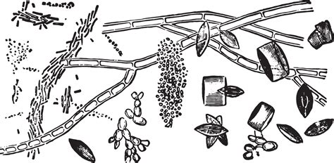 Crystals Of Uric Acid Vintage Engraving 35366360 Vector Art At Vecteezy
