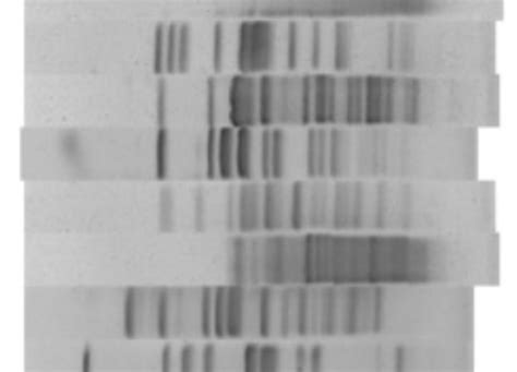Colistin Resistant Escherichia Coli Carrying Mcr 1 In Food Water Hand Rinse And Healthy Human