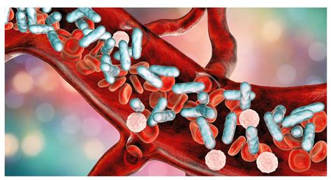 Abubakari Sepsis Prediction Streamlit App At Main