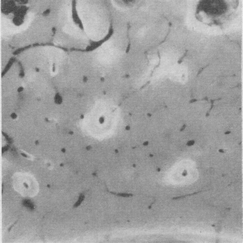 Proximal End Of Tibia Of Day Old Control Download Scientific Diagram