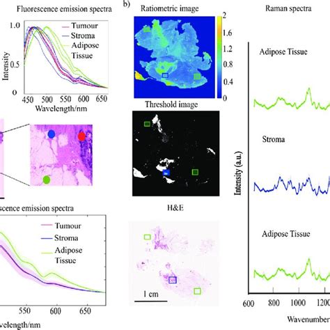 A Fingerprint And High Wavenumber Raman Spectra Of Breast Tissue Download Scientific Diagram
