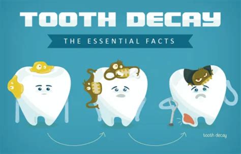 Tooth Decay Pain Cause Damaged Enamel