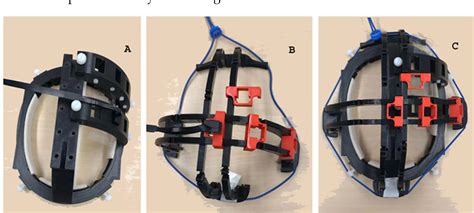 Figure 2 From Improved Biomagnetic Signal To Noise Ratio And Source