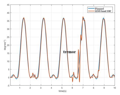Trajectories Of Hip Joint By Leso Based Smc With Spasm And Tremor Download Scientific Diagram
