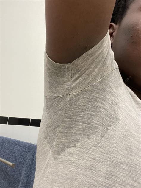 Driclor Users Do You Shave Your Armpits R Hyperhidrosis