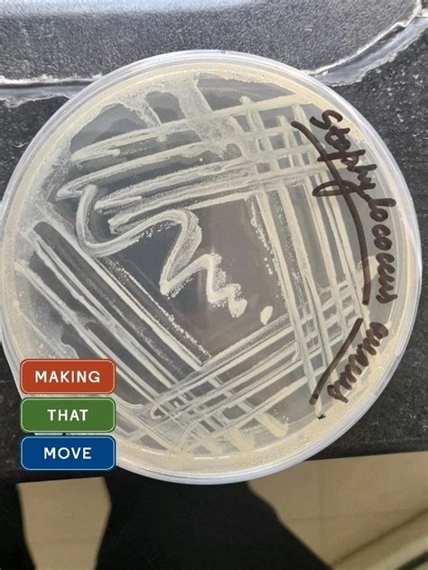 Vanshika Aggarwal On Linkedin Staphylococcus Aureus ⚛︎👩🏻‍🔬is A Bacterium Commonly Found On The