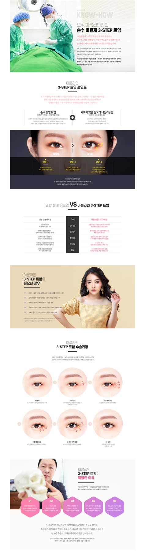 3 Step 트임 쌍커풀 자연유착 비절개뒤트임 눈꼬리올림 트임재수술 윗트임 이마거상 미니거상