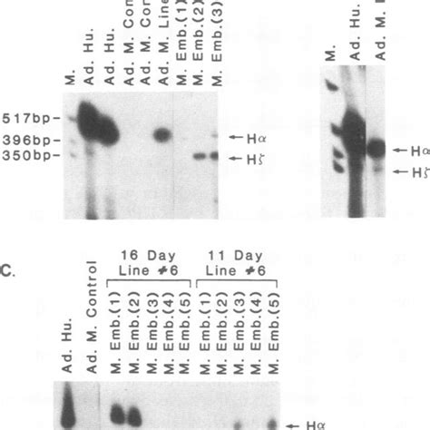 Developmental Switching Of Human A And Globin Gene Expression In