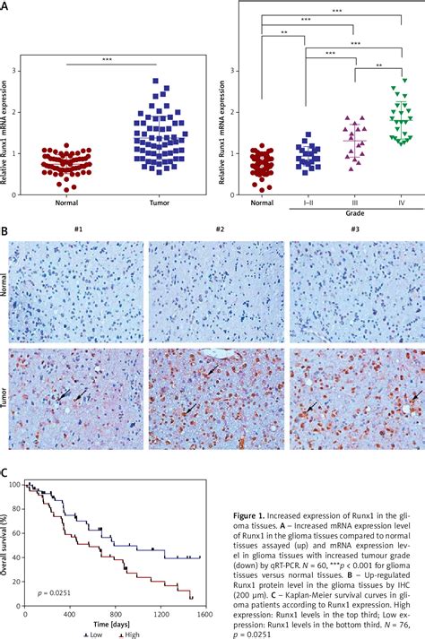 Figure 1 From Runx1 Promotes The Development Of Glioma Cells By