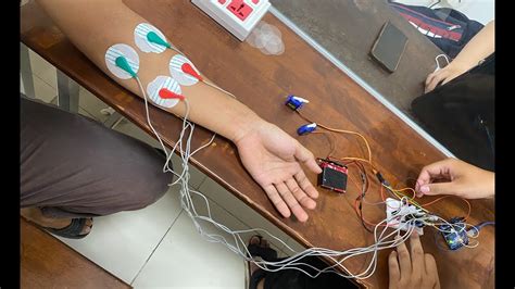 Điều Khiển động Cơ Servo Bằng Arduino Và Cảm Biến Cơ Bắp Emg Trần Duy Khương 2011456 Youtube