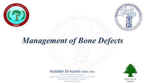 Management Of Bone Defects Pptx