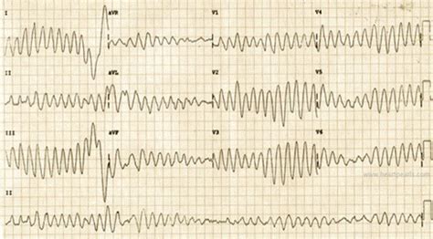 Cardiology