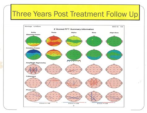 QEEG Analysis Brain Mapping Neurofeedback Integrated Therapy Institute