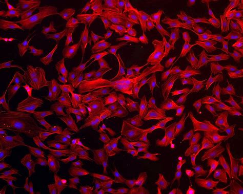Endothelial Cells Update Iriss Mission Blog