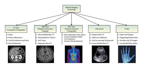 Variational Autoencoders‐basedself‐learning Model For Tumor