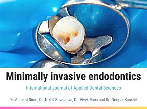 Conservative Access Cavities Minimally Invasive Endodontics A Review