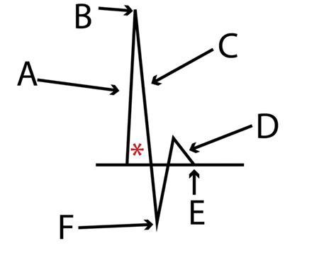 Triphasic Waveform Diagram Diagram Quizlet