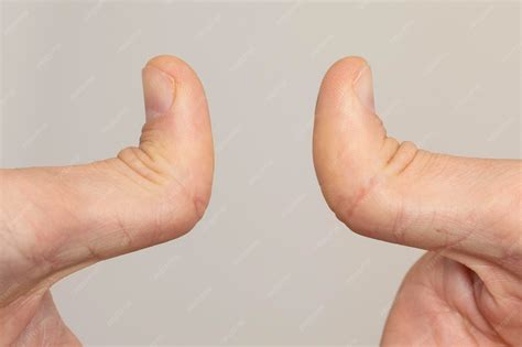 Premium Photo An Extreme Closeup View On The Thumbs Of A Double