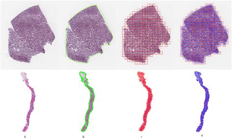 Figure 2 From Context Aware Self Supervised Learning Of Whole Slide
