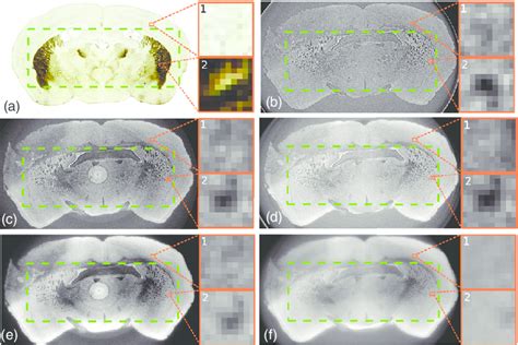 Six Representations Of Our Data A Is A Histological Slice Of A Mouse