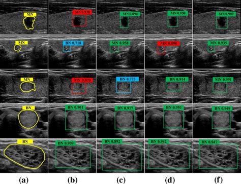 Illustration Of The Improvement Benefiting From Our Improved Cascade Download Scientific