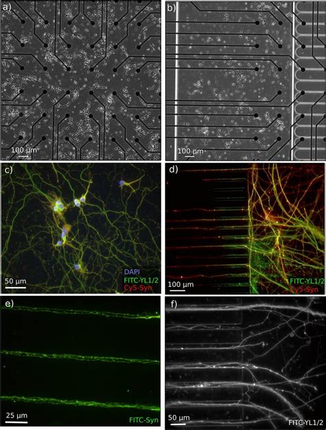 Optical And Fluorescent Micrographs Of Random And Microfluidic Networks Download Scientific