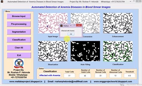 Matlab Code For Anemia Diseases Detection In Blood Cells Smear Using Image Processing