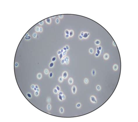 Fungi Micro Exam 1 Flashcards Quizlet
