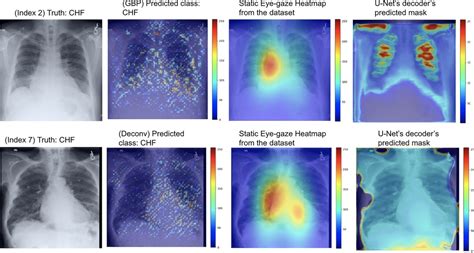 frontiers improving disease classification performance and