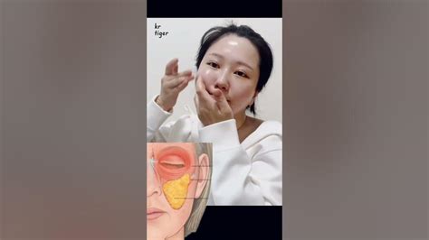 삼십대후반처진광대 팔자주름 앞볼 리프팅 마사지 Youtube