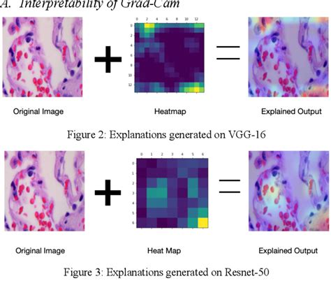 Analysis Of Explainable Artificial Intelligence Methods On Medical Image Classification