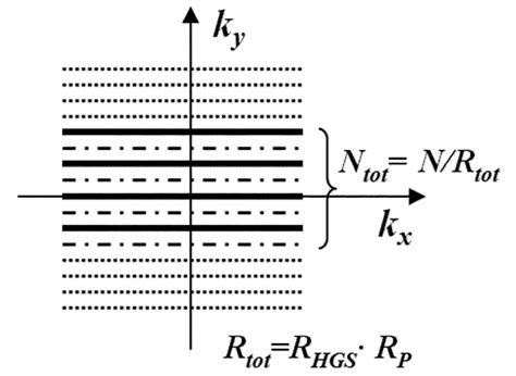 Higher Order Generalized Series Parallel Imaging Method For Acquiring High Spatio Temporal