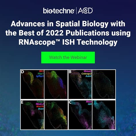 species specific gene expression profiling of patient derived xenograft