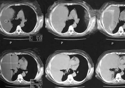 How To Detect Computer Worms