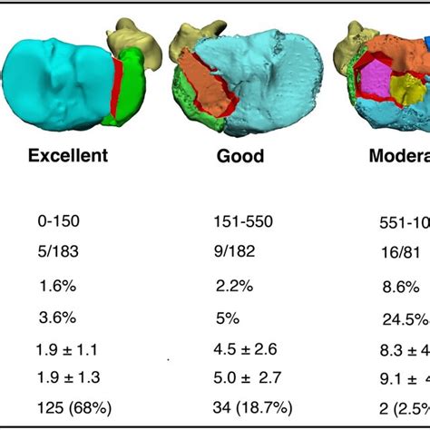 3d Gap Area Red Surface Measurement On A 3d Fracture Model Download Scientific Diagram