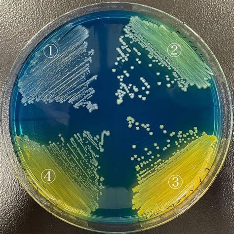 Mikrobilim Acinetobacter Türleri 🌟🌟 ① Acinetobacter