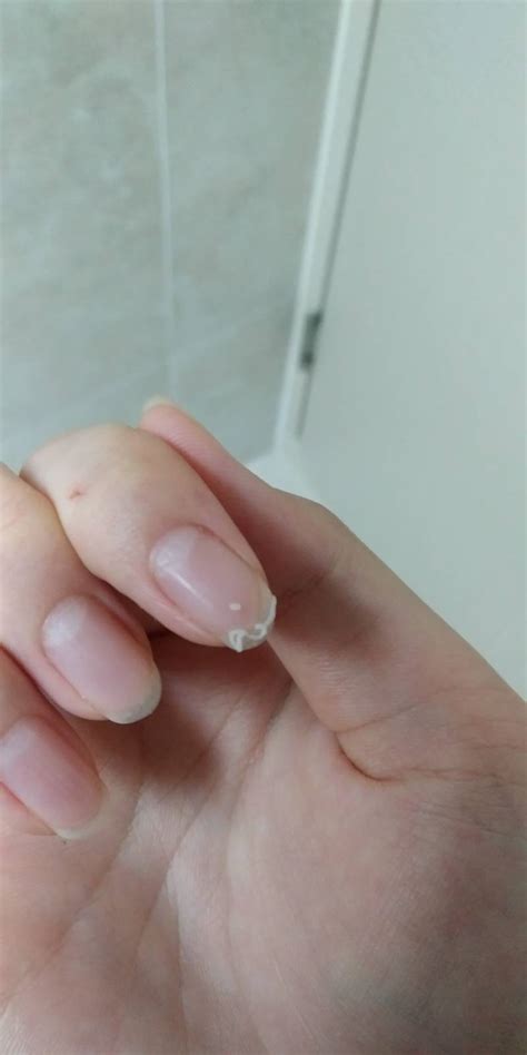 턱에 노란거 여드름 났길래 짰는데 혐오주의 인스티즈instiz 익명잡담 카테고리