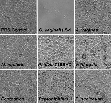 Cytotoxic Changes Of Vaginal Epithelial Cell Monolayers Challenged With Download Scientific