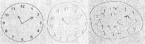 Figure 1 From Automated Analysis Of The Clock Drawing Test For