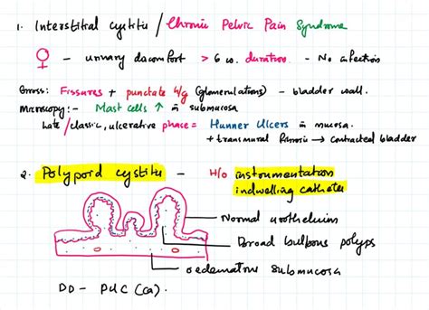 Interstitial Cystitis And Polypoid Cystitis Rpathologyflashcards