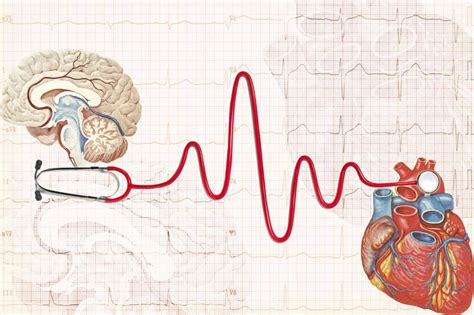 Stroke Protocol Stroke Intervention Universal Hospital