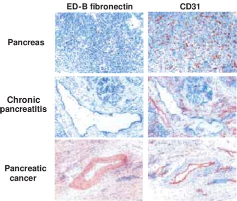 A Specific Expression Of Ed B Fibronectin In Human Tissue Sequential Download Scientific