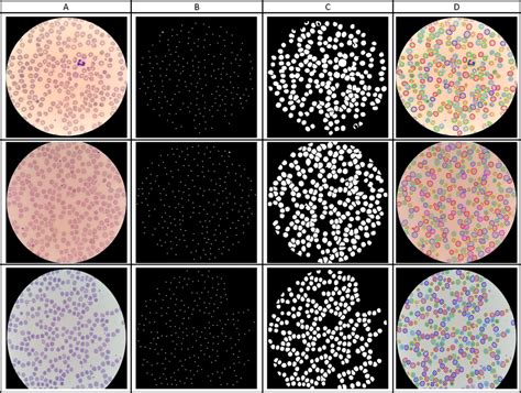 rbc detection and segmentation using level sets a input image b